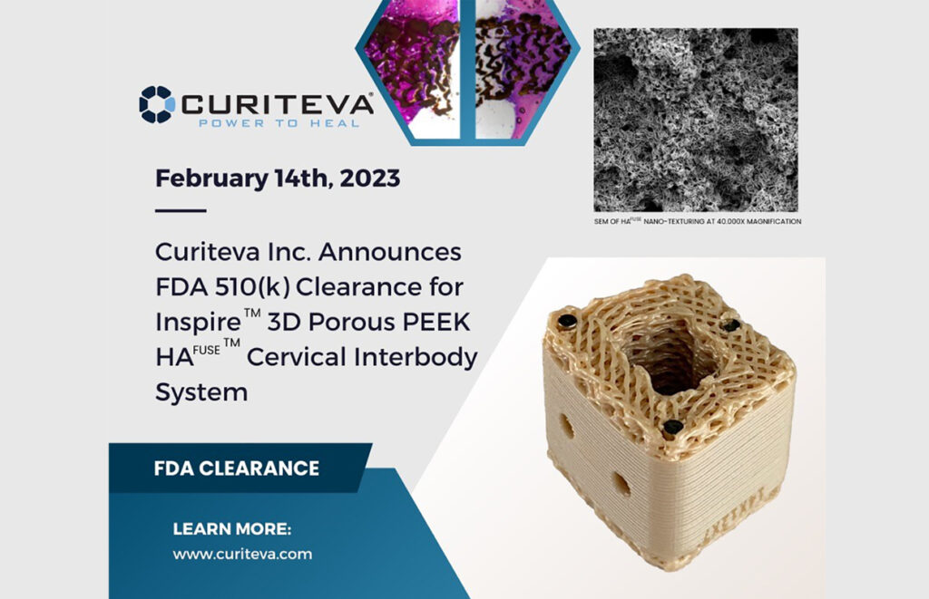Curiteva wins FDA clearance to 3D print spinal implants - 256 Today